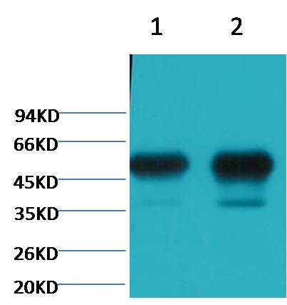 β II tubulin Mouse mAb – Atochembio